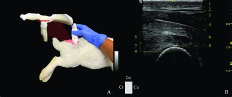 Transducer Positioning And Resulting Ultrasound Image Obtained In A Download Scientific Diagram