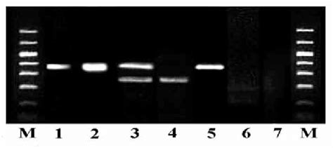 Determination Of Bcr Abl Fusion Transcript Product Obtained By