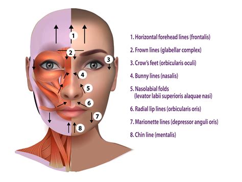 Frontalis Muscle Botox