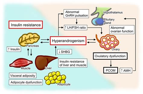 The Flowchart Pathophysiology Of Polycystic Ovary Syndrome Pcos