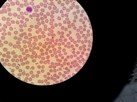 Cuaderno De PrÁcticas HematologÍa Práctica Recuento De Plaquetas En Frotis Sanguíneos