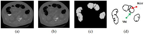 Illustration Of A Tissue Mixture Map Em Segmentation Of The Colon
