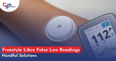 Dexcom G7 Falling Off Problems And Top Tips For Secure Wear