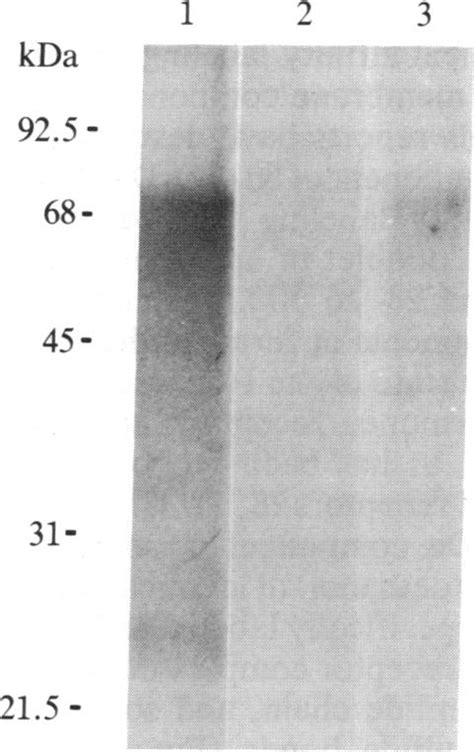 Autoradiograph Of Eluates From Immunoaffinity Column Affinity Purified
