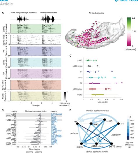 Figure 1 From Parallel And Distributed Encoding Of Speech Across Human