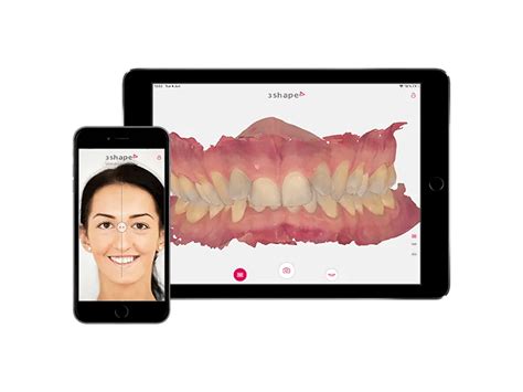 Software Smile Design Dentadec