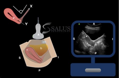 Obi Lecture 1c Flashcards Quizlet