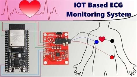 Electromyography With Myoware Muscle Sensor And Arduino