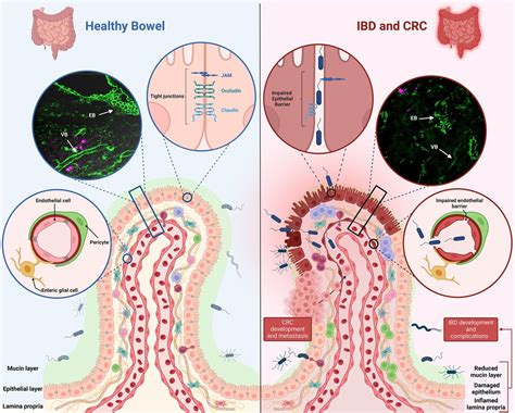 Lamina Propria Intestine Inflammation