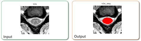 Computing The White Matter Segmentation Spinal Cord Toolbox Documentation