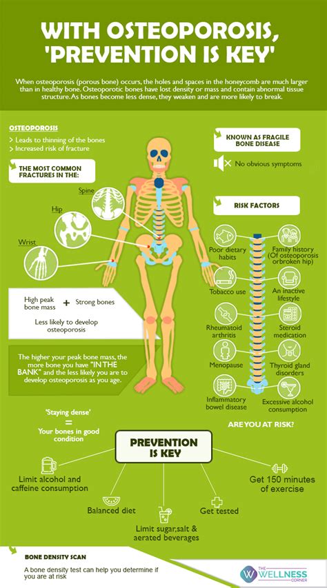 With Osteoporosis Prevention Is The Key The Wellness Corner