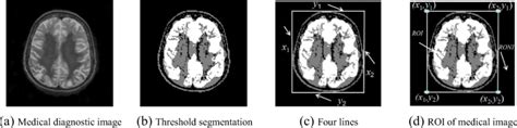 Medical Image Region Segmentation Download Scientific Diagram