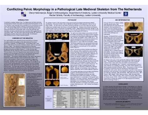 Pdf Conflicting Pelvic Morphology In A Pathological Late Medieval