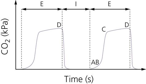 Noninvasive Monitoring Clinical Tree