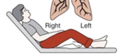 Pulmonary Drainage Positions Flashcards Quizlet