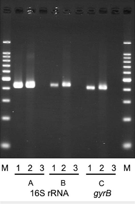 Figure 2 From A Case Of Uncomplicated Bacteremia Caused By