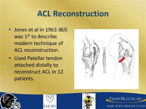 PPT ACL Reconstruction The Anatomic Approach PowerPoint Presentation ID