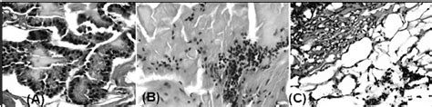 Representation Of Hande‐stained Slides Of The Formalin‐fixed