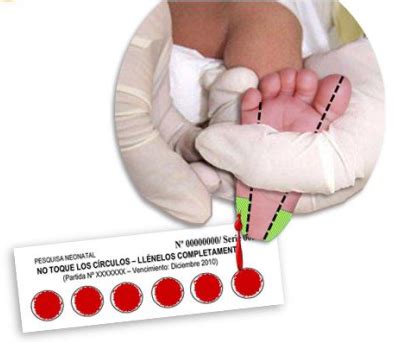 Pesquisa Neonatal Un Procedimiento Necesario Portal Garrahan