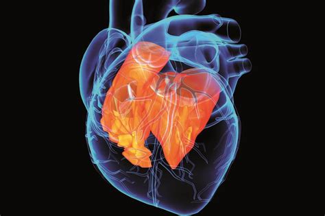 Sex And Drugs And CVD