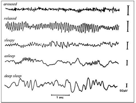 11eeg Waveforms For Different Physical States 39 Download