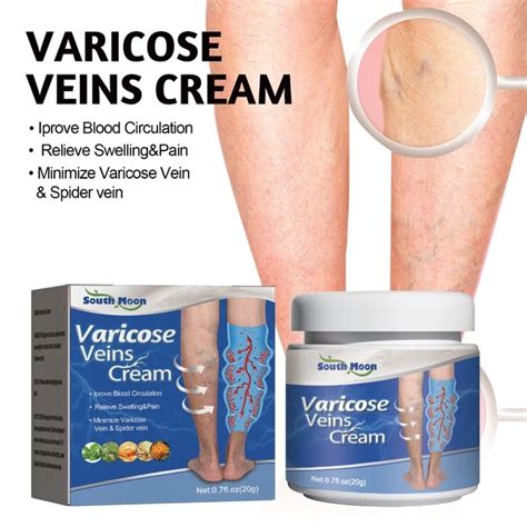 Varicose Veins Relief Cream Vasculitis Phlebitis Spider Pain Relief