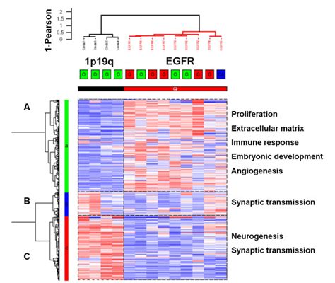 Unsupervised Clustering Of 4 Oligodendrogliomas With 1p19q Codeletion