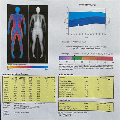 DEXA Scan Experience MyFitnessPal Com