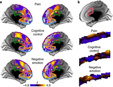 Identifying Latent Brain Representations That Predict The Occurrence Of