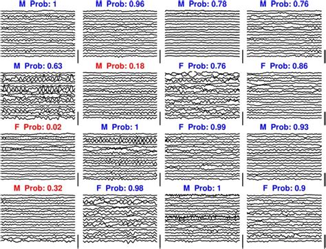 Predicting Sex From Brain Rhythms With Deep Learning Scientific Reports