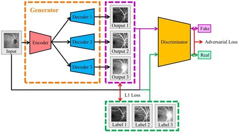 Series Parallel Generative Adversarial Network Architecture For Translating From Fundus