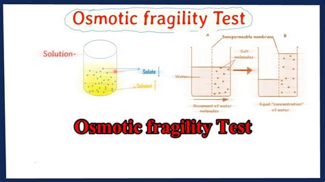 Labcorp Osmotic Fragility At Gayla Wilson Blog