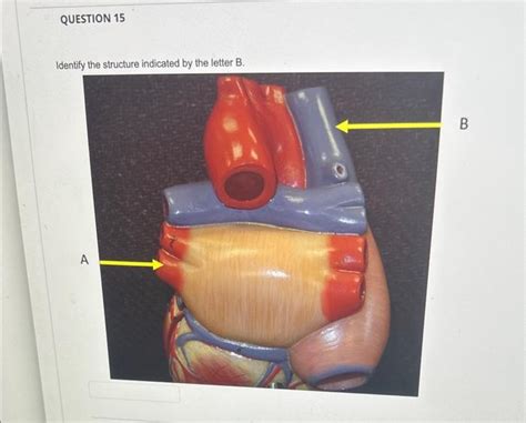 Solved Identify The Structure Indicated By The Letter B Chegg Com