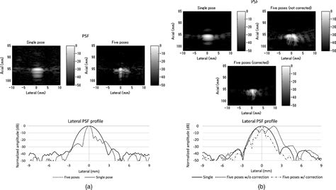 Synthetic Tracked Aperture Ultrasound Imaging Design Simulation And Experimental Evaluation