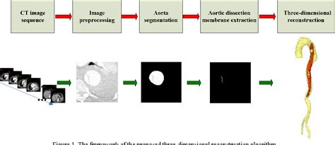 Figure 1 From Segmentation Of The Aortic Dissection From Ct Images Based On Spatial Continuity