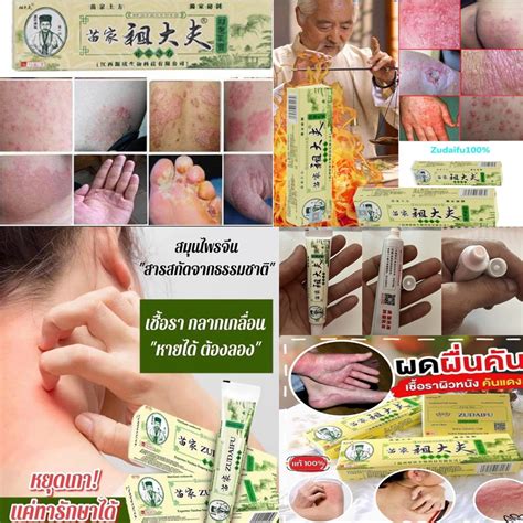 อาการคันตามผิวหนัง มีตุ่มขึ้น คือ ผื่นคันที่เกิดขึ้นบนผิวหนัง เป็นอาการ