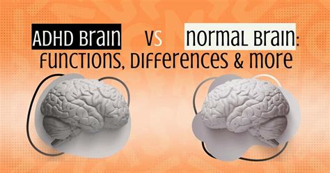 ADHD Brain Vs Normal Brain Functions Differences More