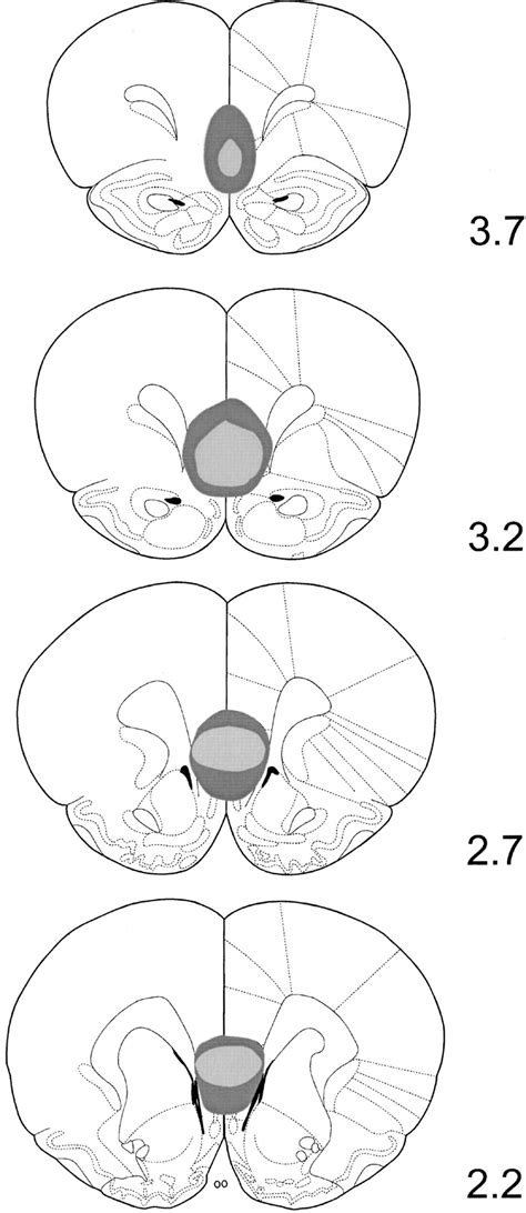 Lesions Of Rat Infralimbic Cortex Enhance Recovery And Reinstatement Of