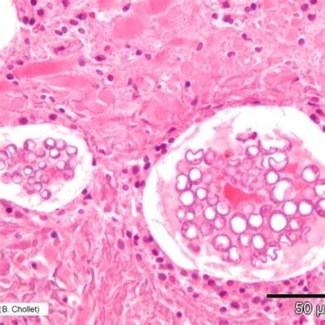 Muscle Tissue From The Foot Of Ruditapes Philippinarum Infected By