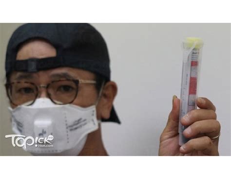 Allergy Fatal Anaphylaxis Due To Fire Ant Stings