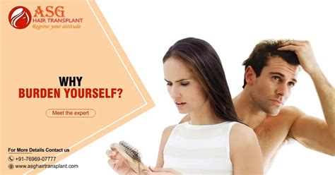 How To Know If You Are Going Bald