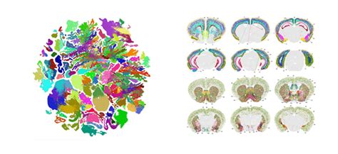 Mapping The Whole Mouse Brain Vizgen