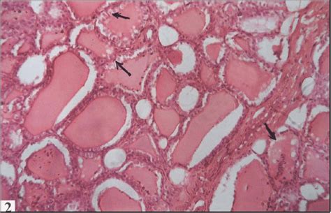 Magnified View Of The Thyroid Gland Of Control Rat Exhibiting Follicles Download Scientific