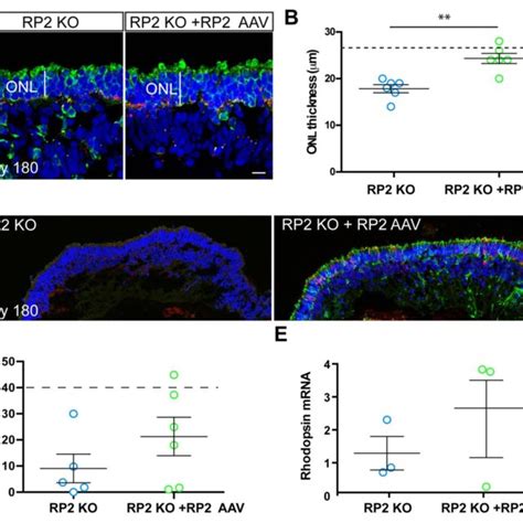 Photoreceptor Differentiation Associated Cell Death In Rp2 Ko Organoids Download Scientific