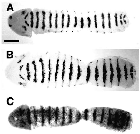 Expression Of Gsb And Prd Proteins And Pax3 Mrna Under Control Of The