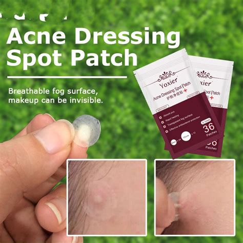 Acne Dressing Spot Patch Xpresswift