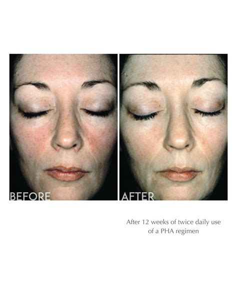 overnight transformation complex 50gr dermasouqs ae