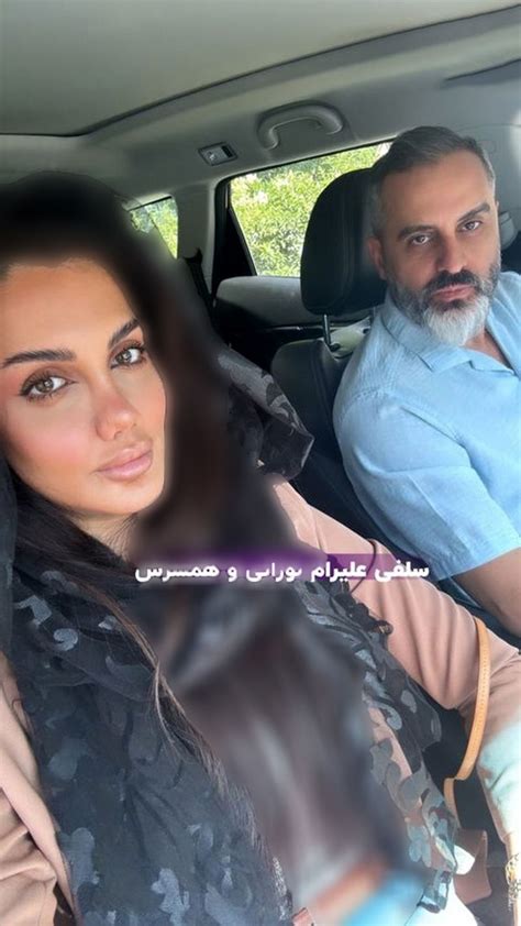 عکس همسر عروسکی علیرام نورایی بعد از تزریق ژل لب چقدر باکلاس و جذاب؟