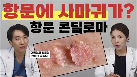 항문에 사마귀가 항문 콘딜로마 치료방법 Ft 대장항문외과전문의와 산부인과 전문의가 알려주는 항문 콘딜로마 Youtube