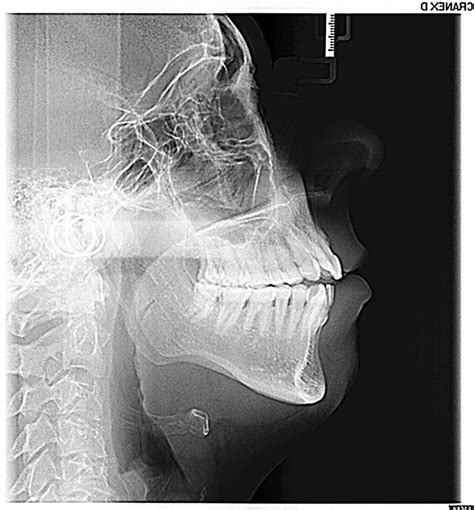 Reliability And Accuracy Of Artificial Intelligence Based Software For